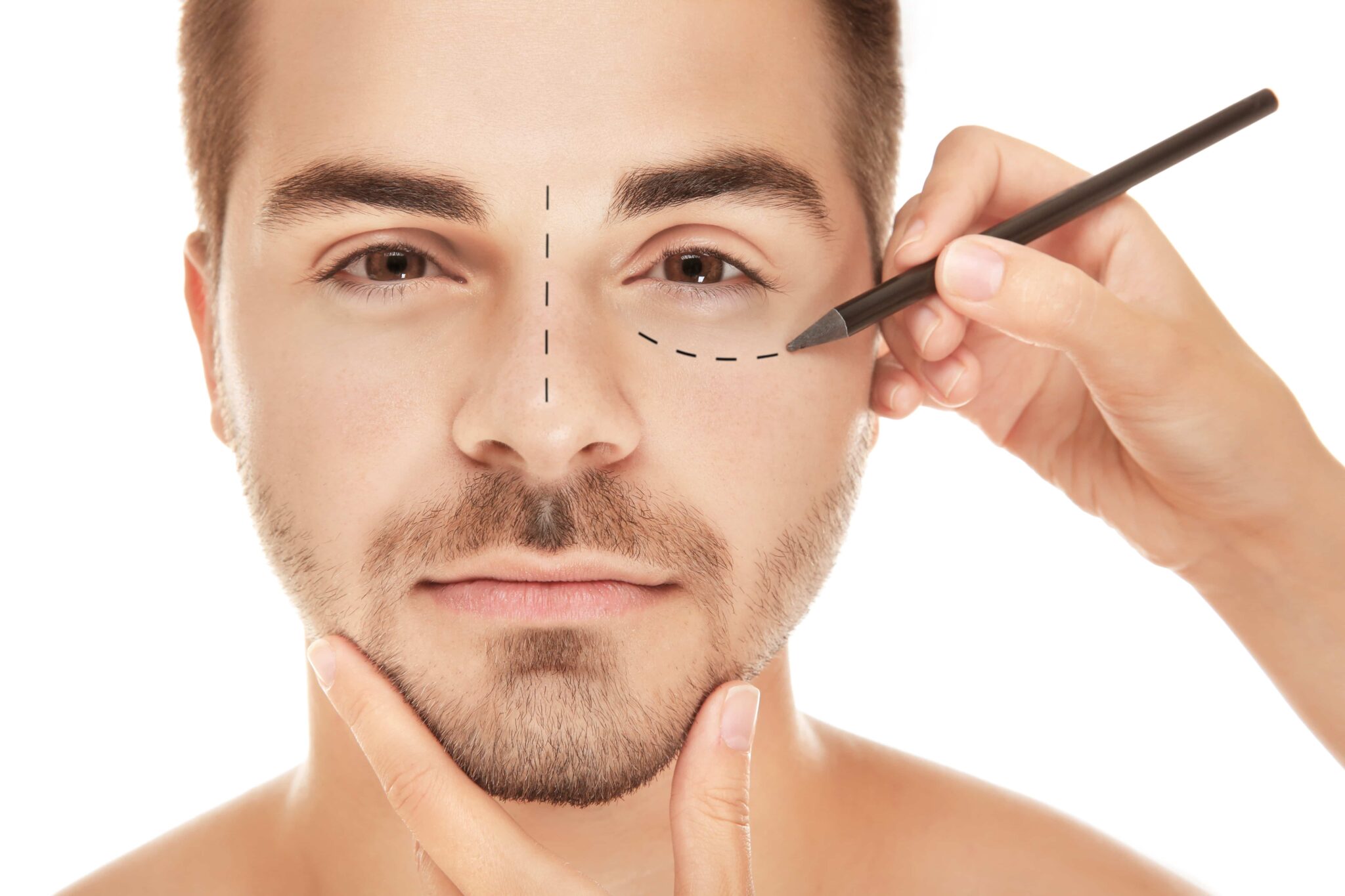 Tips for Blepharoplasty Surgery that Everyone Should Know |Dr. Sidle